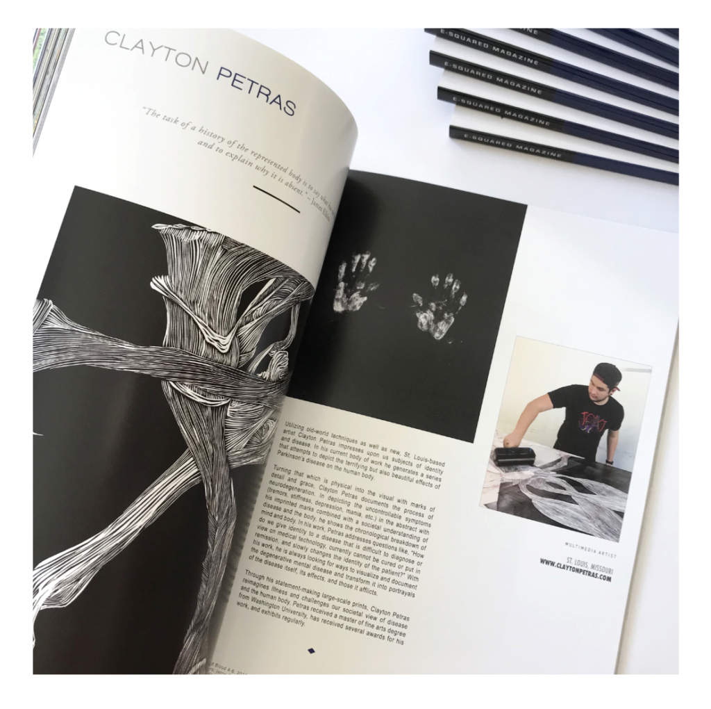 A Possible Cause: Progress & Promise for Parkinson’s – E-Squared Magazine